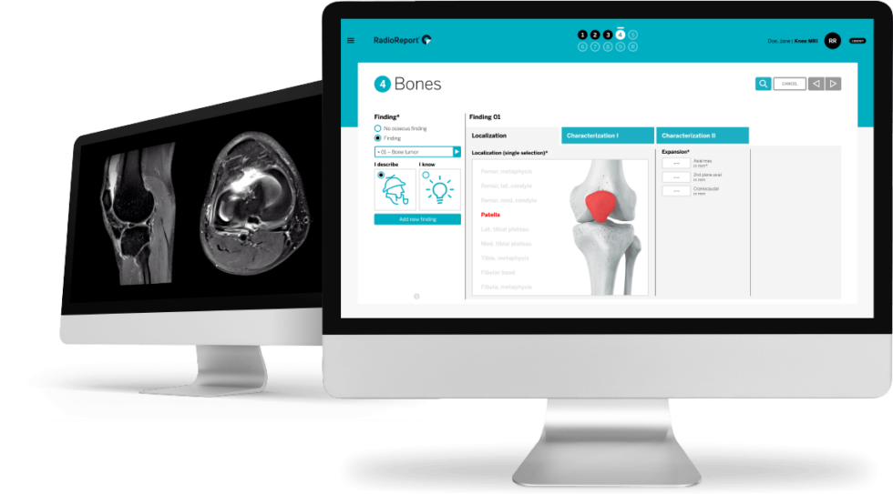 Radiology Reporting Software | RadioReport®